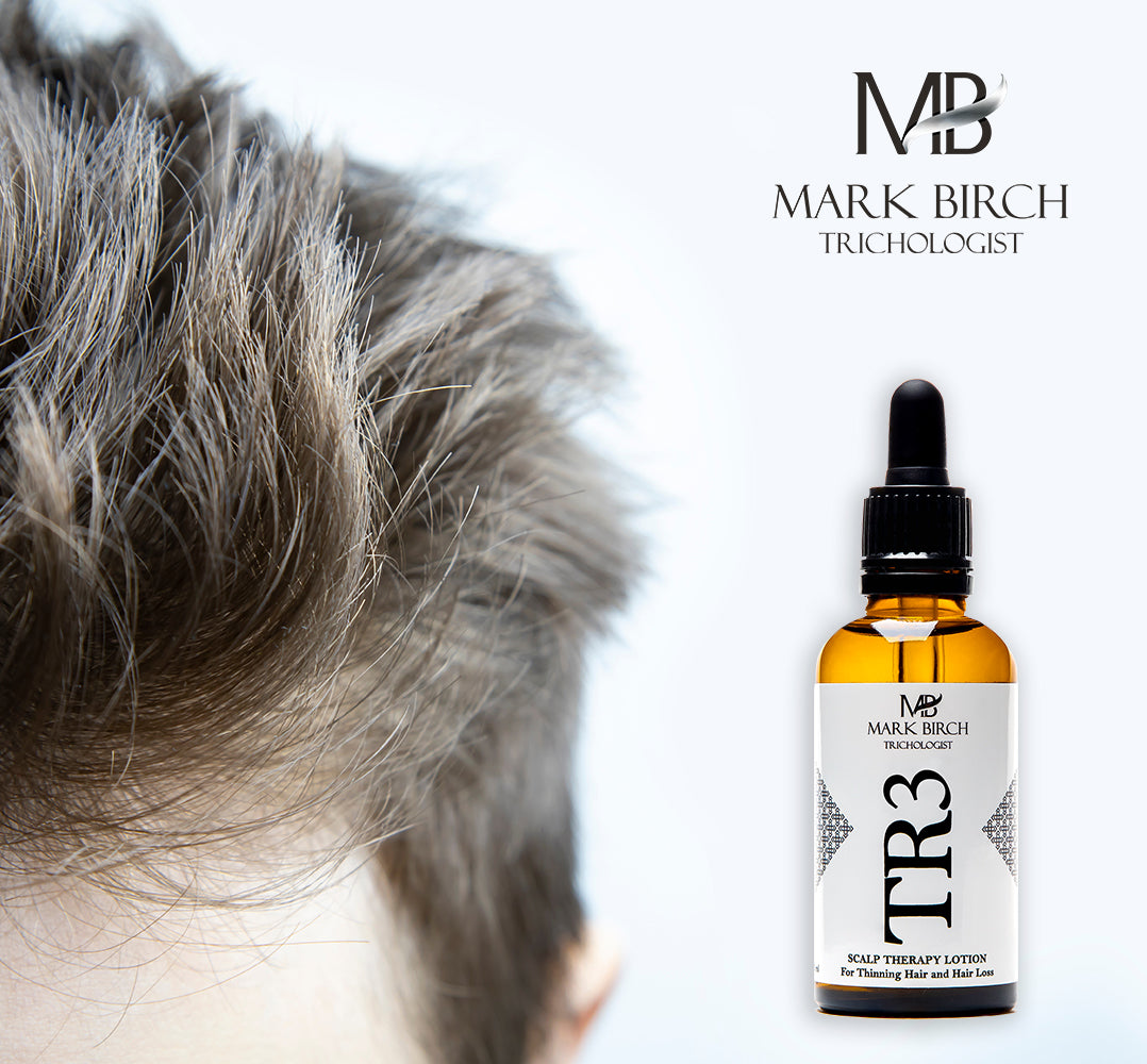 Hair Loss Range – MARK BIRCH HAIR