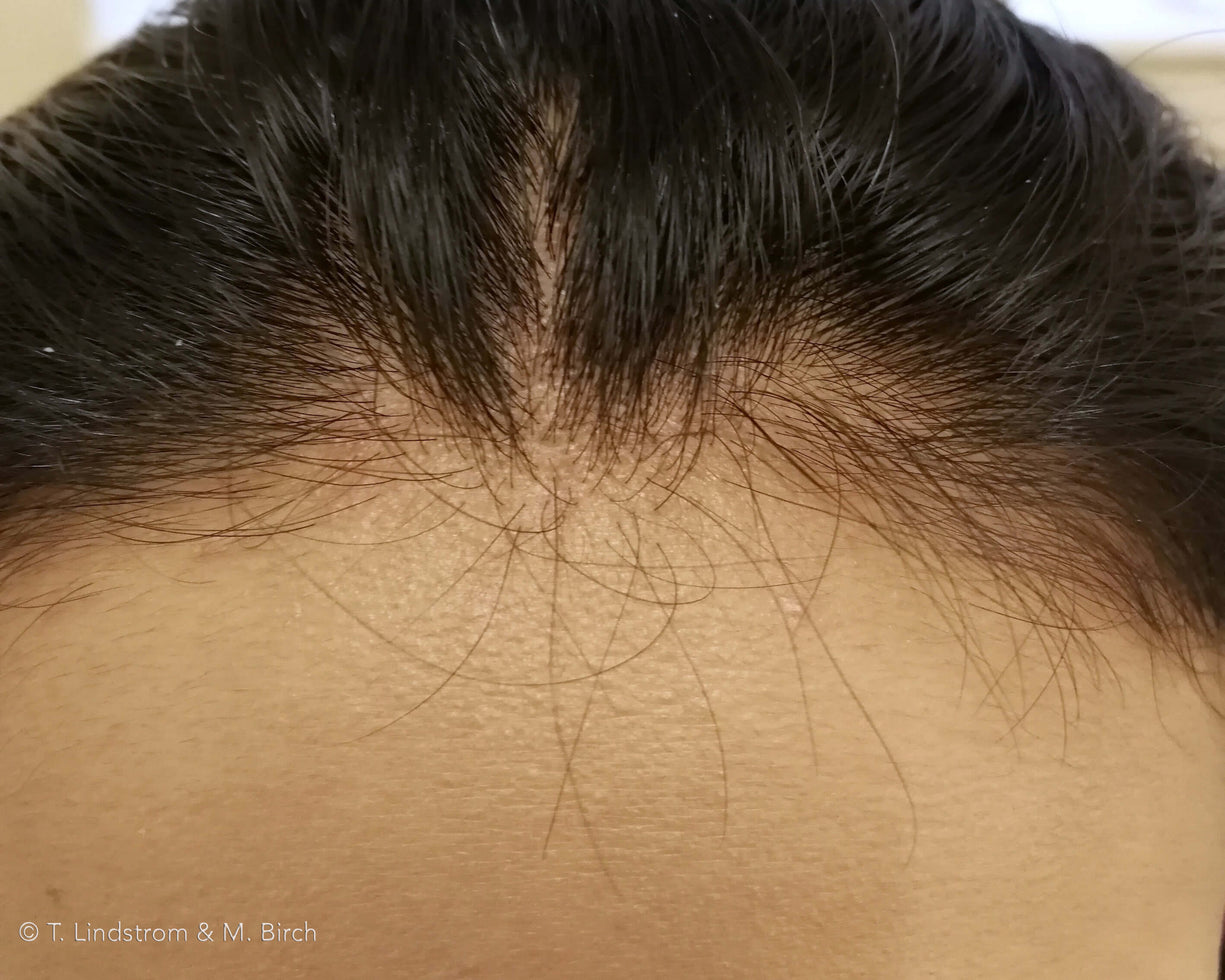 Before & After – MARK BIRCH HAIR