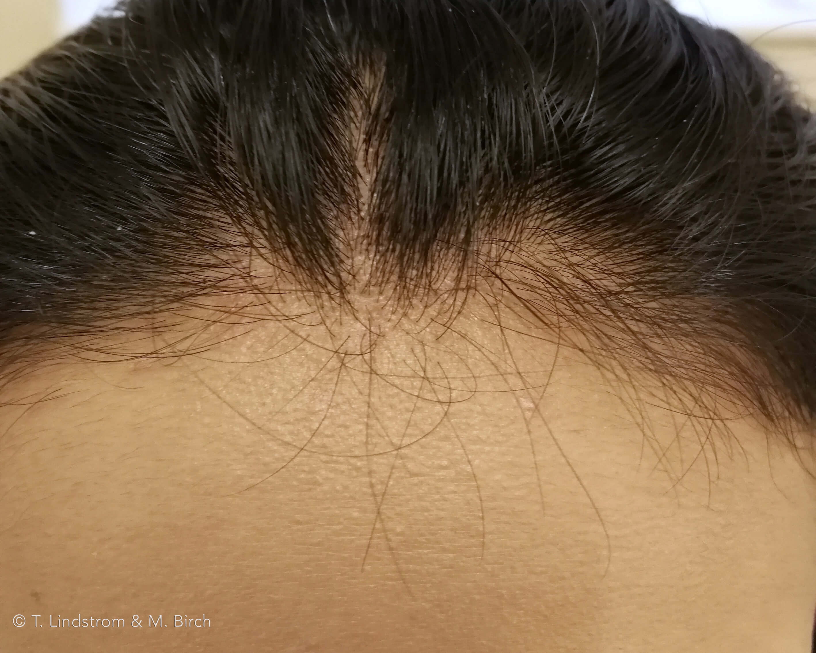 Before & After – MARK BIRCH HAIR