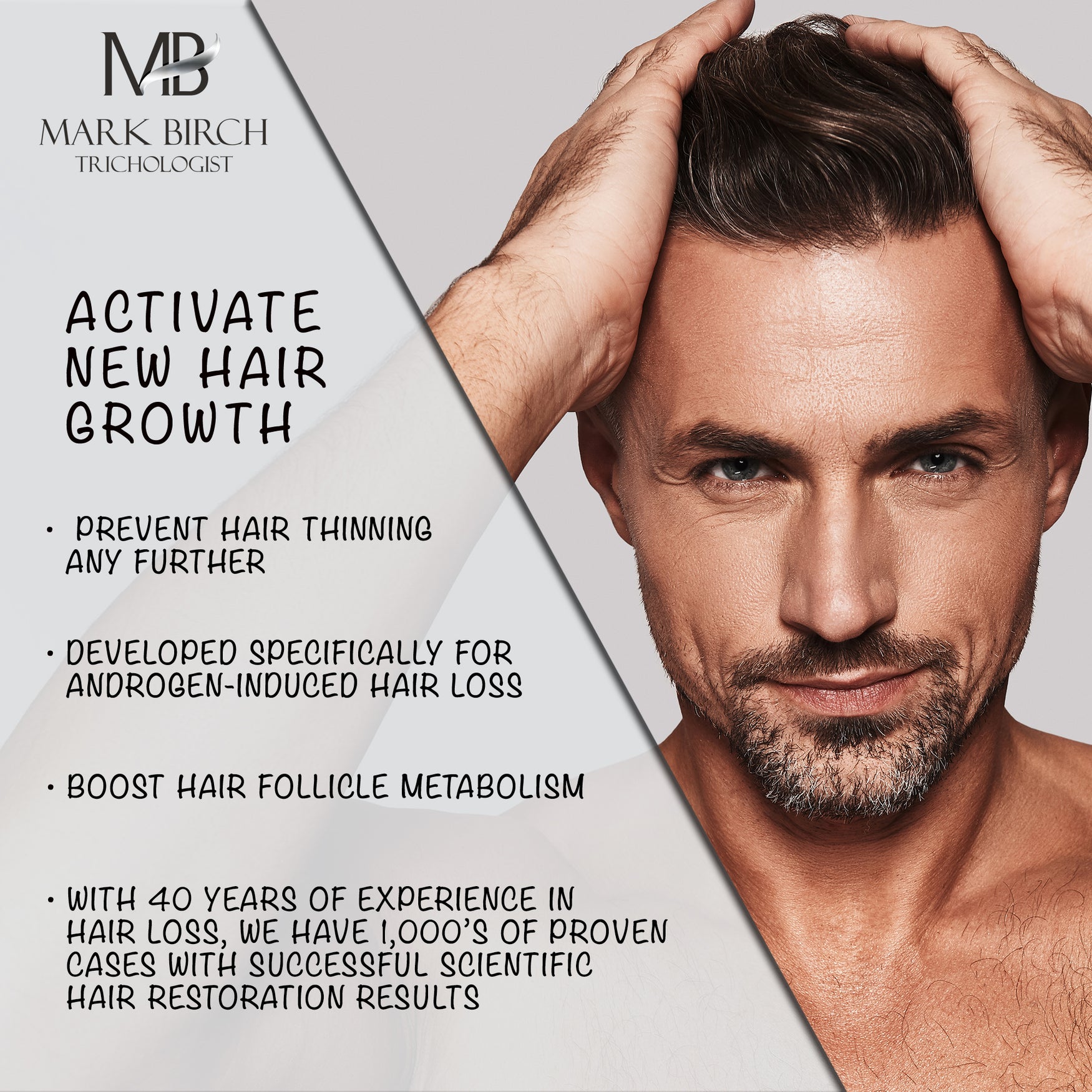 Hair Loss – MARK BIRCH HAIR